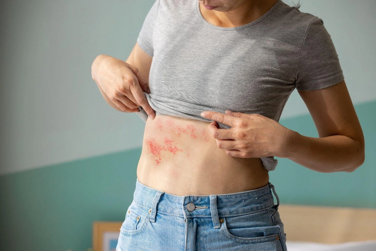 Skin Allergy Diagnosis & Treatment in Singapore - Livingstone Dermatology